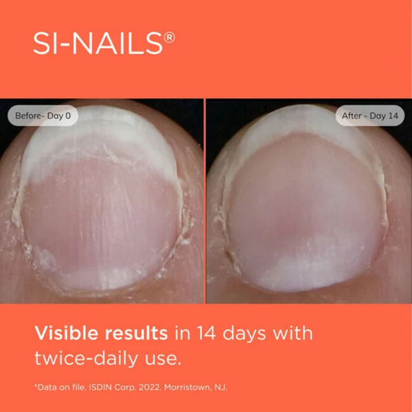 ISDIN SI-Nails Serum | Nail Strengthening Treatment | ShopMDSkincare.com